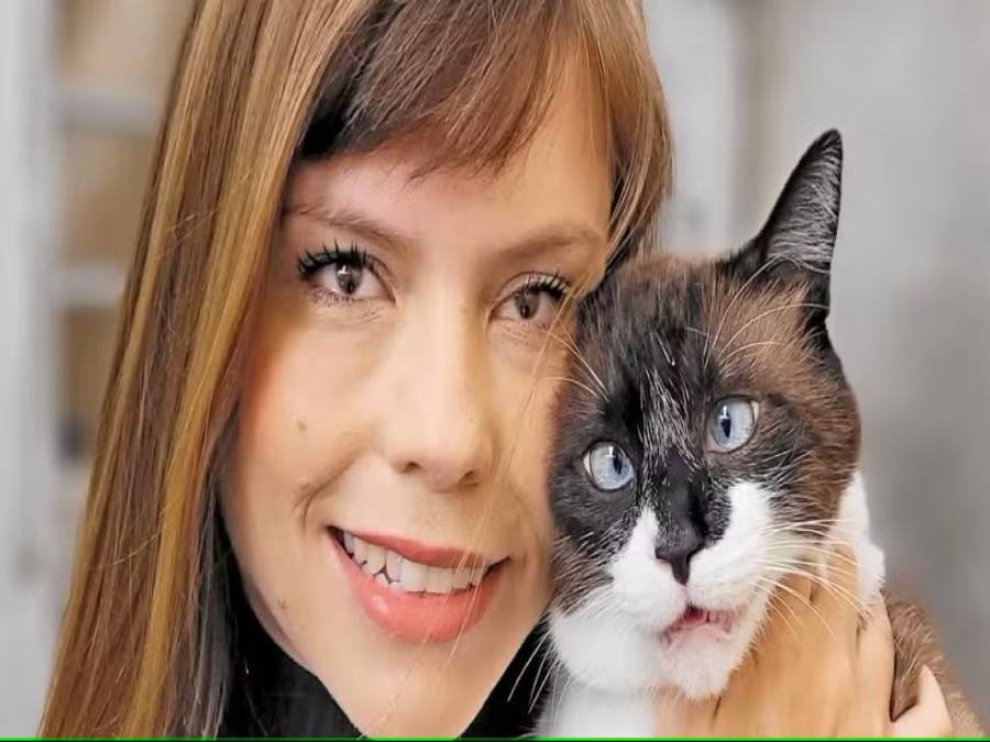 Jovem vive com 'olho de gato', condição rara que mudou formato das ...